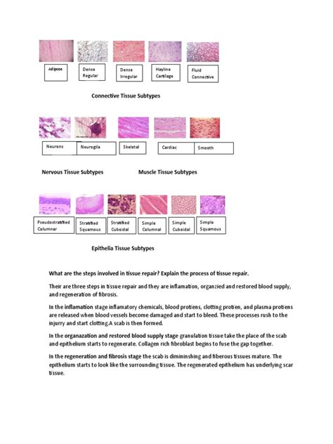 Connective Tissue Types Chart