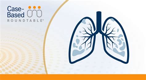 Targeted Oncology On Linkedin Discussing Non Clinical Barriers To Ngs Testing For Nsclc