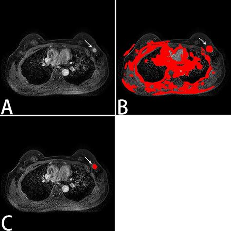 three cases for the segmentation results which were obtained by
