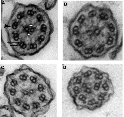A Normal Ciliary Ultrastructures As Seen On Transmission Electron