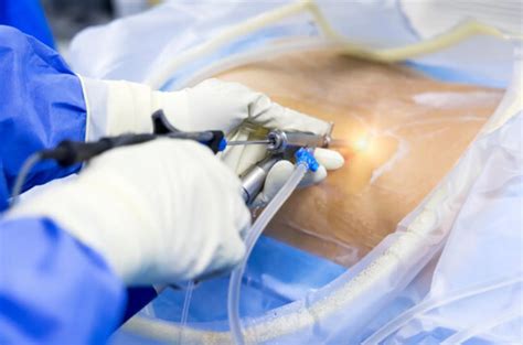 Minimally Invasive Spine Surgery The Spine Clinic