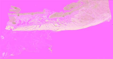 Svs To Dzi Results In Pink Images · Issue 2897 · Libvipslibvips · Github