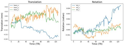 Preprocessing — Dartbrains
