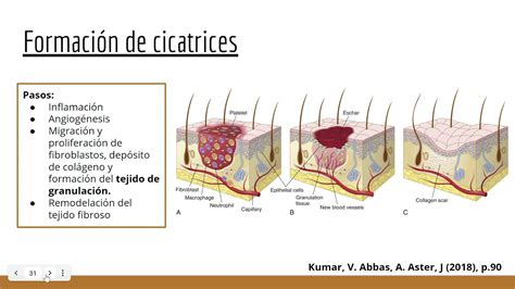 Renovacin Reparacin Y Regeneracin Tisular Factores De Crecimiento Y