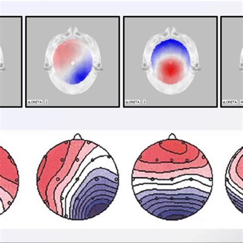 Left Column The Four Common Microstate Scalp Maps Middle And Right Download Scientific