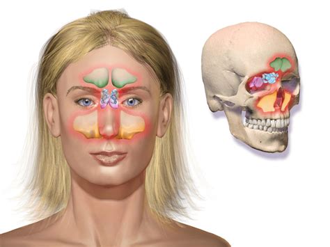 Difference Between Rhinitis And Sinusitis Compare The Difference