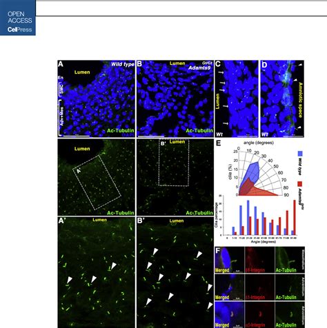 Adamts9 Mediated Extracellular Matrix Dynamics Regulates Umbilical Cord