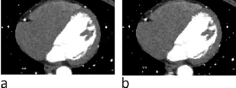 Impact On Temporal Resolution An Expanded View Of The Heart Region In Download Scientific