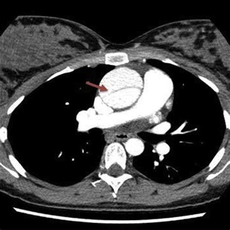 Cardiac Computed Tomography Download Scientific Diagram
