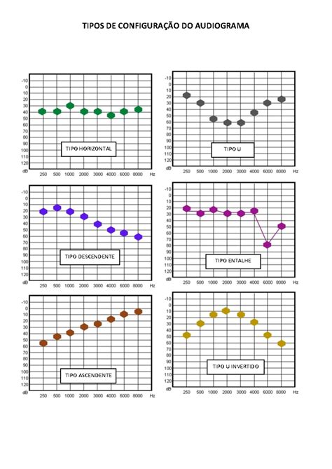 Tipos De Configuração Do Audiograma Diagrama De Blocos Tipos De