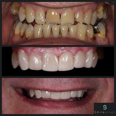 Smile Fast Smileology