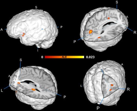Brain Regions Showing Significant Activation Likelihood Across Download Scientific Diagram