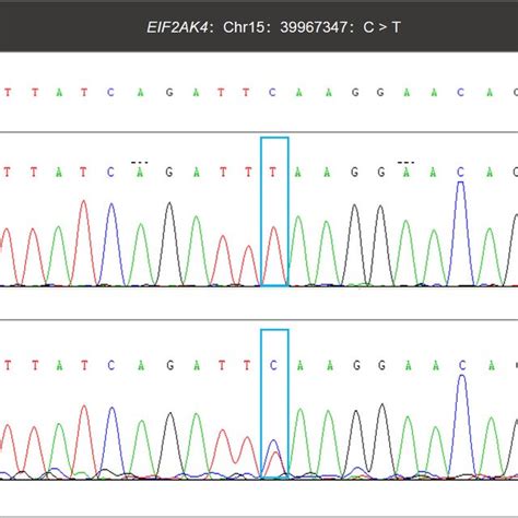 Representative Electropherogram Of Sanger Sequencing Identified An