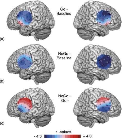 Statistical Activation Maps Paired T Tests Of Cerebral O 2 Hb