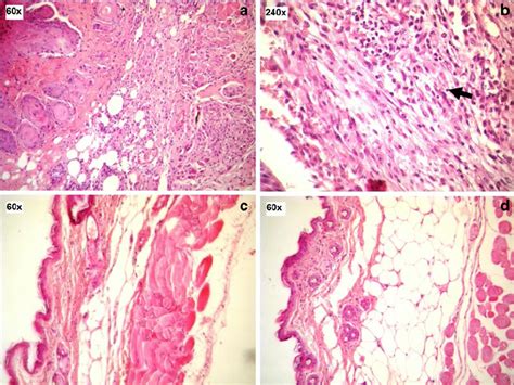 In Vivo Cumulative Release Profile For Etoposide Loaded Implants