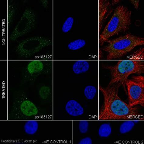 Anti Glucocorticoid Receptor Antibody Epr19621 Ab183127 Abcam