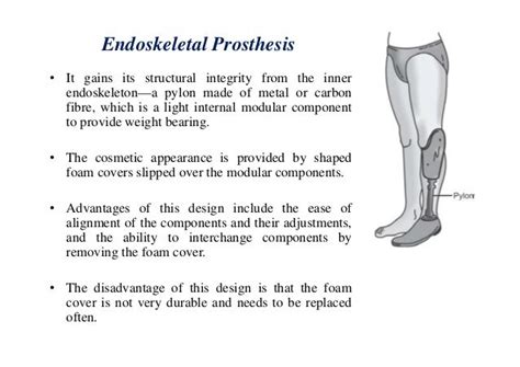 Prosthesis