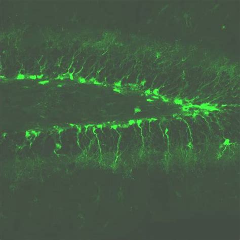 Gensat Project At Rockefeller University Mouse Brain Atlas Image Navigator