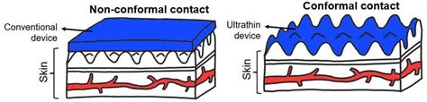 Schematic Illustration Of Interface Between Electrode And Skin
