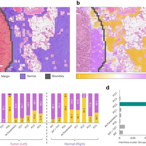 Tumor Margin Estimation A Ground Truth Map Was Generated To Highlight