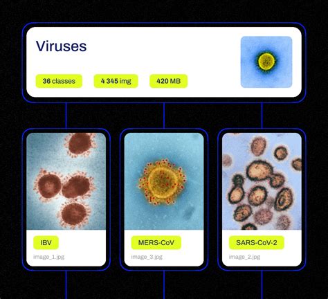 Ultralytics 비전 Ai의 세계 혁신