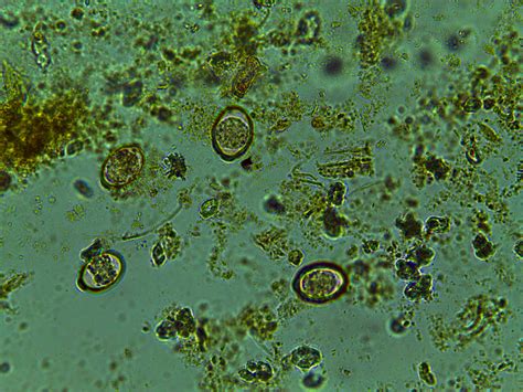 🔥 Free Download What Is This Protozoa Parasite Can Someone Help In The