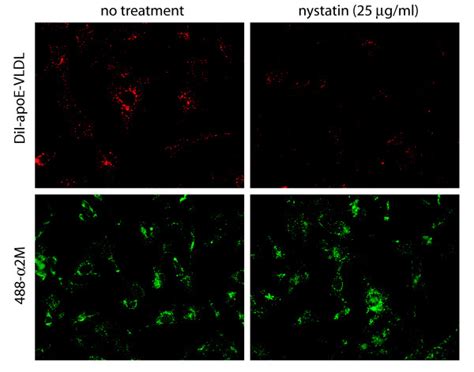 Syn 1 Internalizes Dii Apoe Vldl Through A Lipid Raft Mediated Pathway Download Scientific