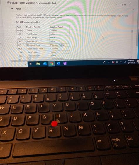 Solved Microlab Tutor Multitest Systems Api 20e 1 Of 1