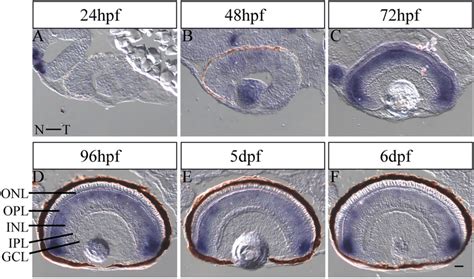 Expression Pattern Of Lhx4 In Zebrafish Retinal Development All