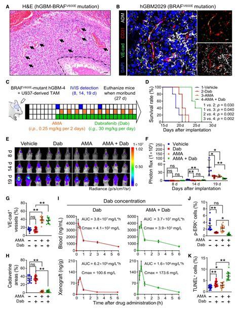 客户案例 Cancer Cell：if 50 3！卞修武院士团队揭秘胶质母细胞瘤治疗新篇章—巨噬细胞展现血管正常化治疗新潜力 肿瘤细胞 氨基酸代谢 非靶向代谢 脂质 多组学代谢流检测分析