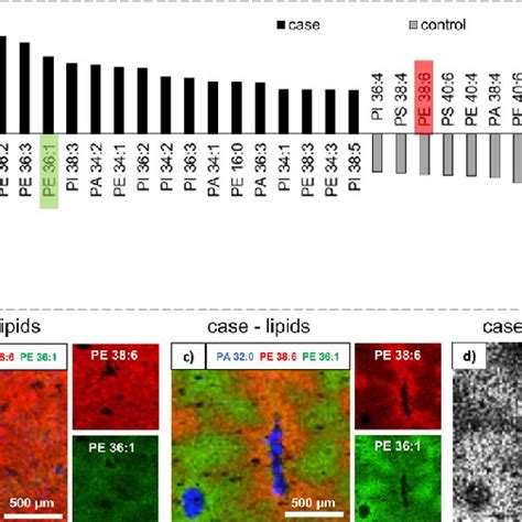 Pfoa Identification And Localization In The Pfoa Exposed Liver For One Download Scientific