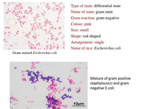 Bacterial Staining