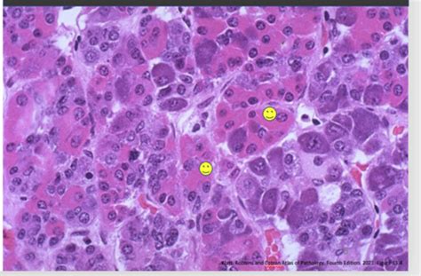 Endo Exam 1 Images Flashcards Quizlet