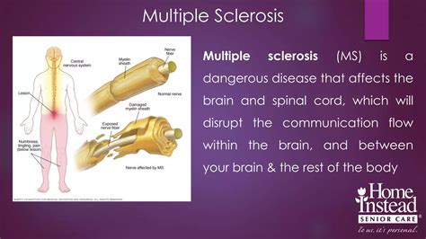 Signs And Symptoms Of Multiple Sclerosis Ppt
