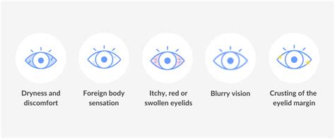 What Is Meibomian Gland Dysfunction Key Symptoms Causes And