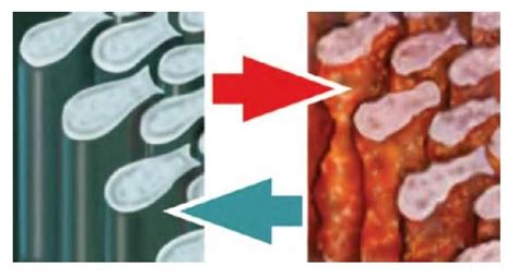 Erosion And Hypersensitivity Treatment Stannous Fluoride Toothpaste Dentalcare