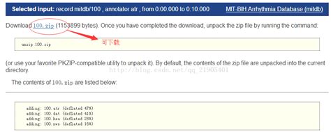 图解mit bih数据库心电数据下载和matlab读取程序 physiobank atm mitdb库如何下载数据 csdn博客