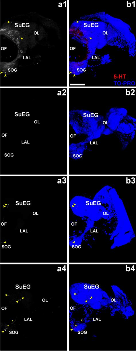 5 Htr426 Yeast Induces Serotonergic Neural Defects In The Larval Brain Download Scientific