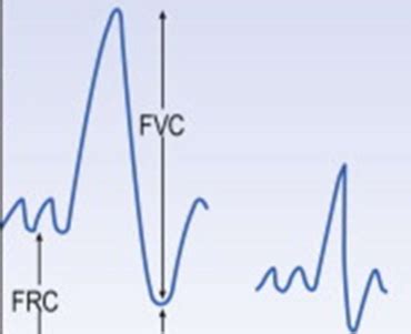 Pulmonary Function Tests Flashcards Quizlet