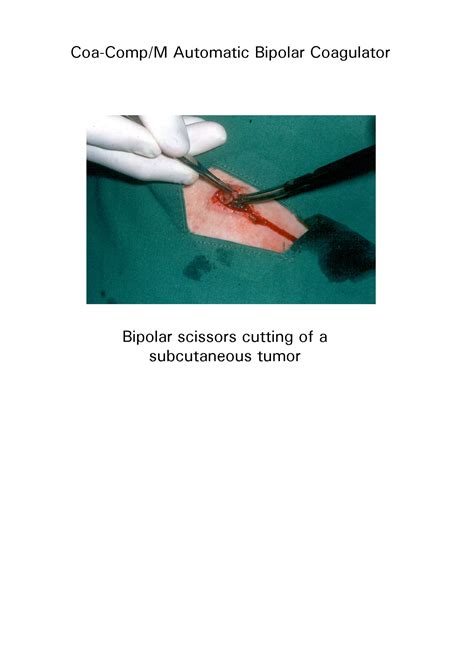 Circumcision Using Bipolar Scissors Pdf