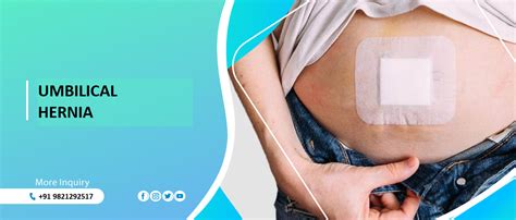 Umbilical Hernia Hernia Surgery Clinic