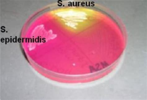 Differential Media Labisolation Of Bacteria Lab Micro Flashcards