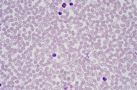 Lab A P 1 Flashcards Quizlet