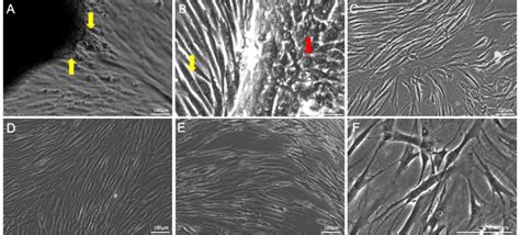 Morphological Characteristics Of Gingival Fibroblasts For Passages 1 4 Download Scientific
