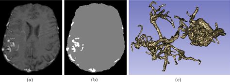 Figure 1 From Image To Mesh Conversion For Biomedical Simulations