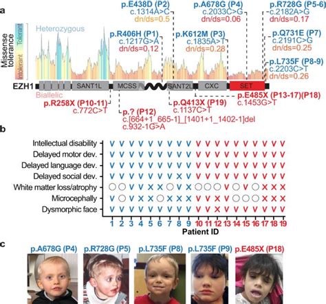 Gain And Loss Of Function Variants In Ezh1 Disrupt Neurogenesis And Cause Dominant And Recessive