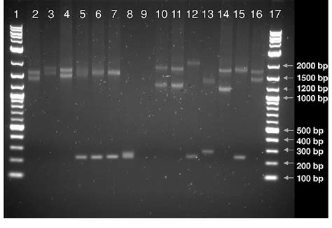 Pcr Analysis Of The Gaa Repeat Polymorphism The Expected Wild Type Download Scientific Diagram