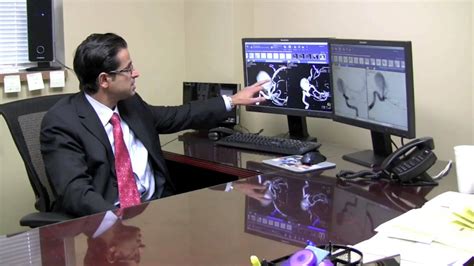 What Is A Pipeline Embolization Device How Is It Used To Treat Norton Neuroscience Institute