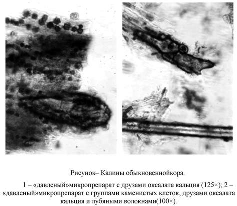 Калины обыкновенной кора Viburni opuli cortex