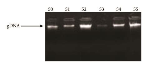 Agarose Gel Electrophoregram Of Genomic Dna Extracted From